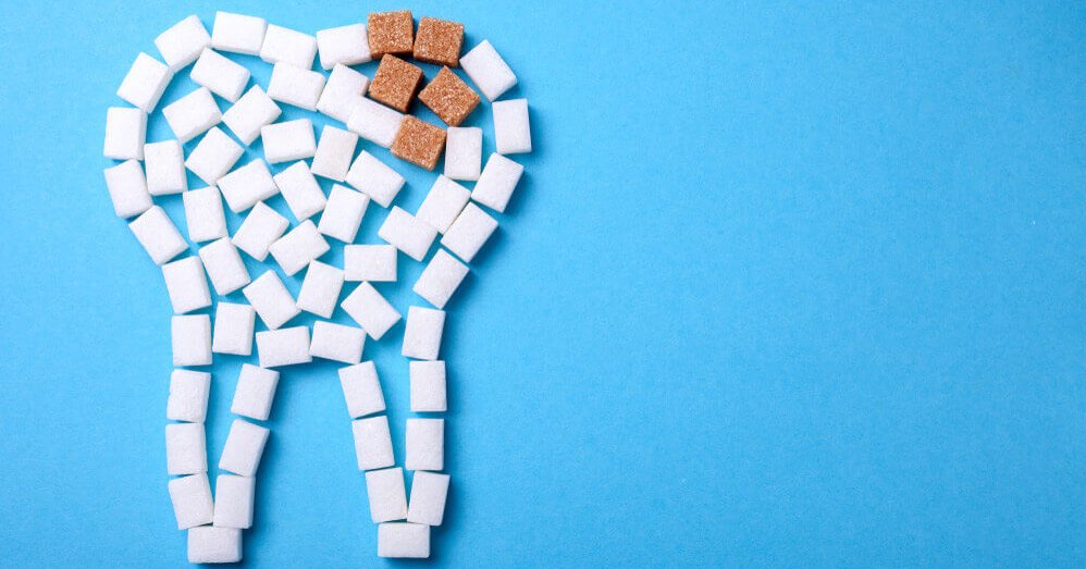 Les caries chez les enfants : reconnaissance et conseils de prévention